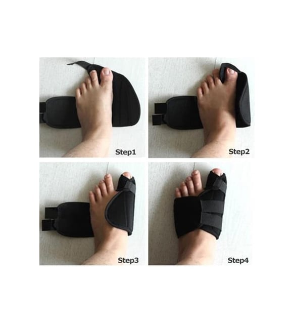 Halluks Valgus Ayak Ateli Ayak Başparmak Kemiği Çıkıntısı Bunyonu Düzeltici